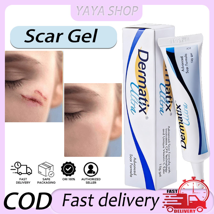 Dermatix Intense Scar Gel | For Scar Removal & Skin Repair | Treats ...