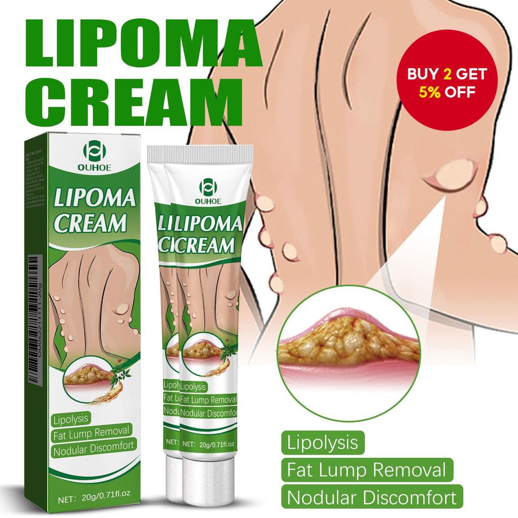 Ointment for Removing Adipose Tumors, Cream for Ganglion Cyst Care ...