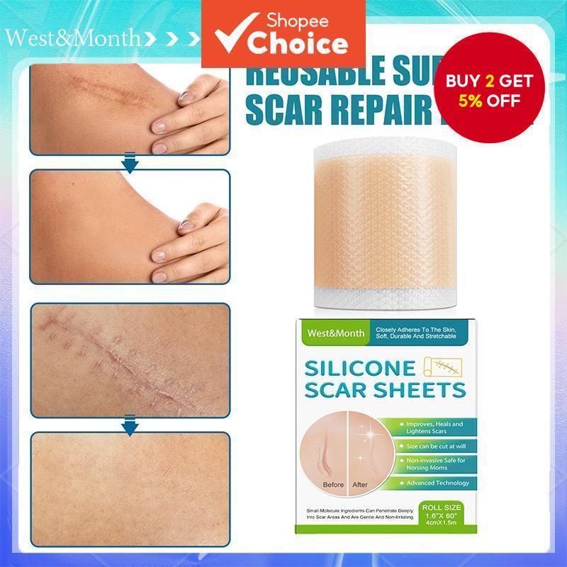 West&Month Silicone Scar Patch 4*150cm Fade All Kinds of Scars Smooth ...