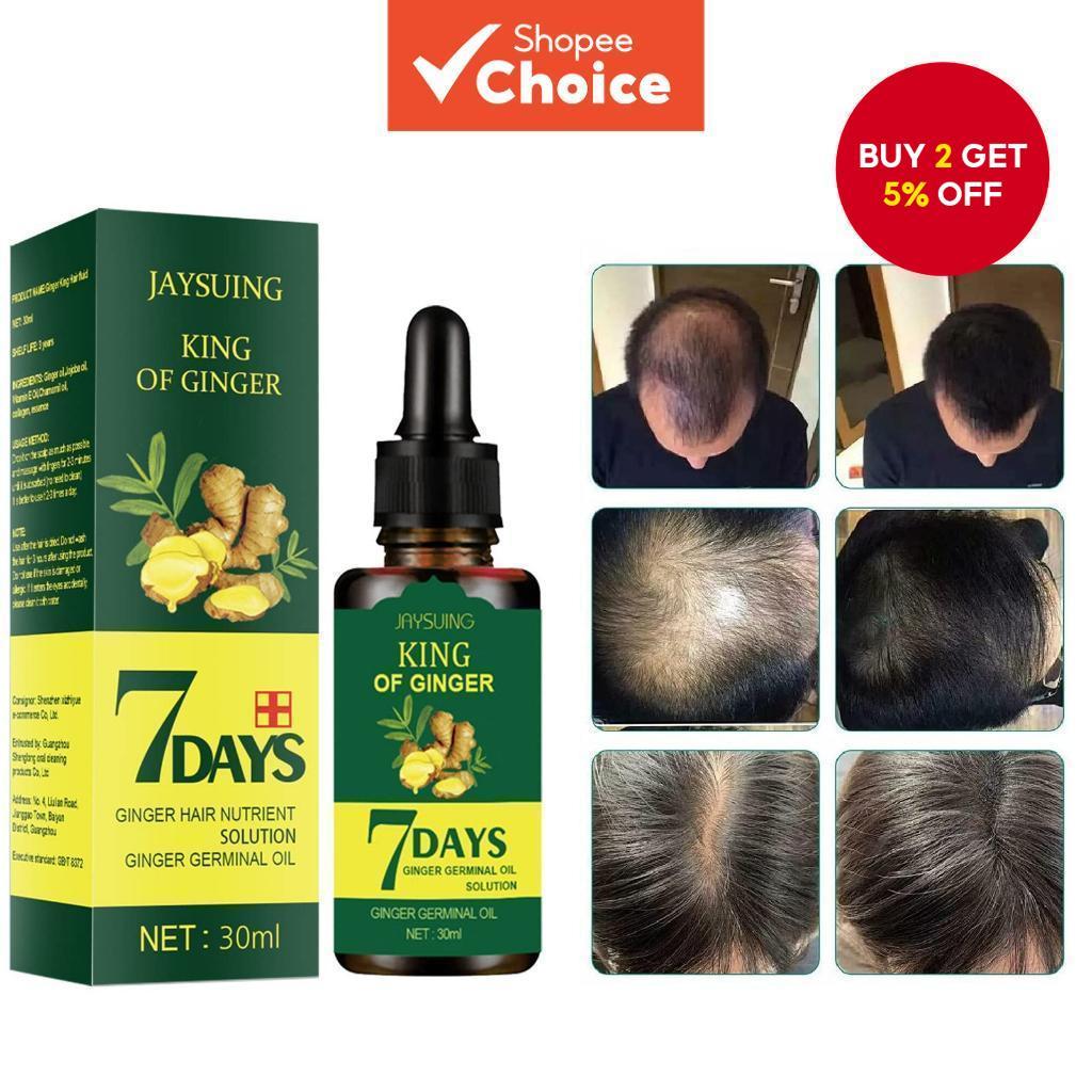 Original King of Ginger Hair Nourishing Oil 7 Days Ginger Germinal ...