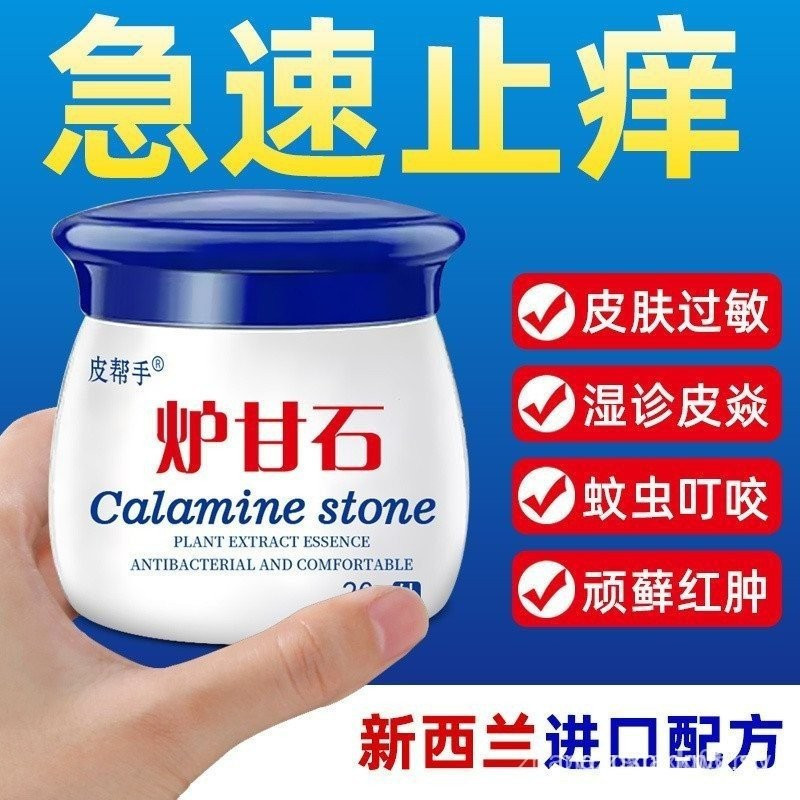Calamine Fast Anti-Itching Skin Itching Dry Whole Body Skin Allergy ...