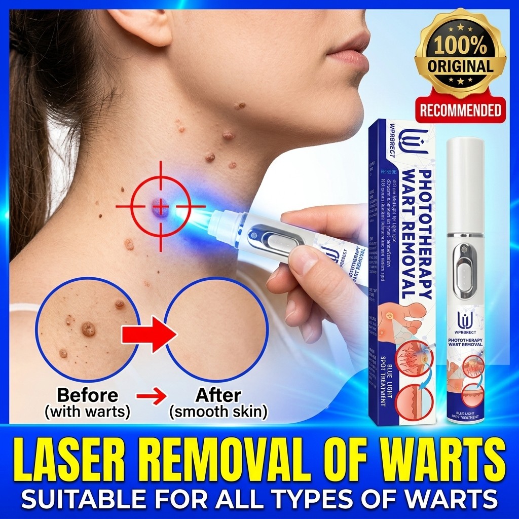 Home Laser Wart Removal Pen - Painless and Non-invasive | Effectively ...