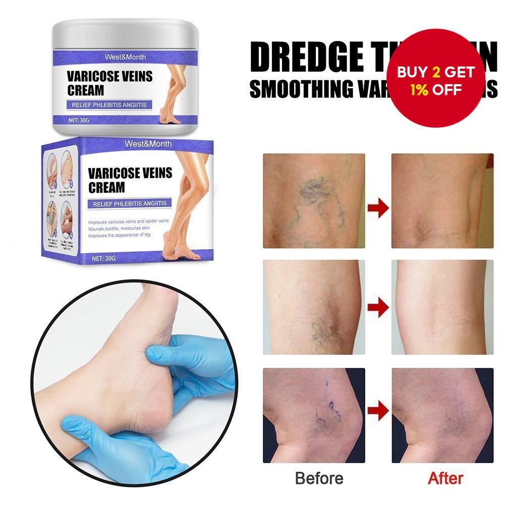 New Varicose Veins Smooth Cream for Spider Vein Pain Relief and ...
