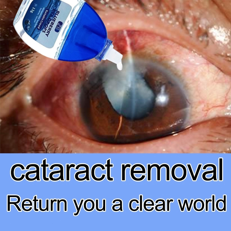 Blueberry Eye Drop Ubat Katarak Mata Eye Drops for Dry Eye/Mata Merah ...