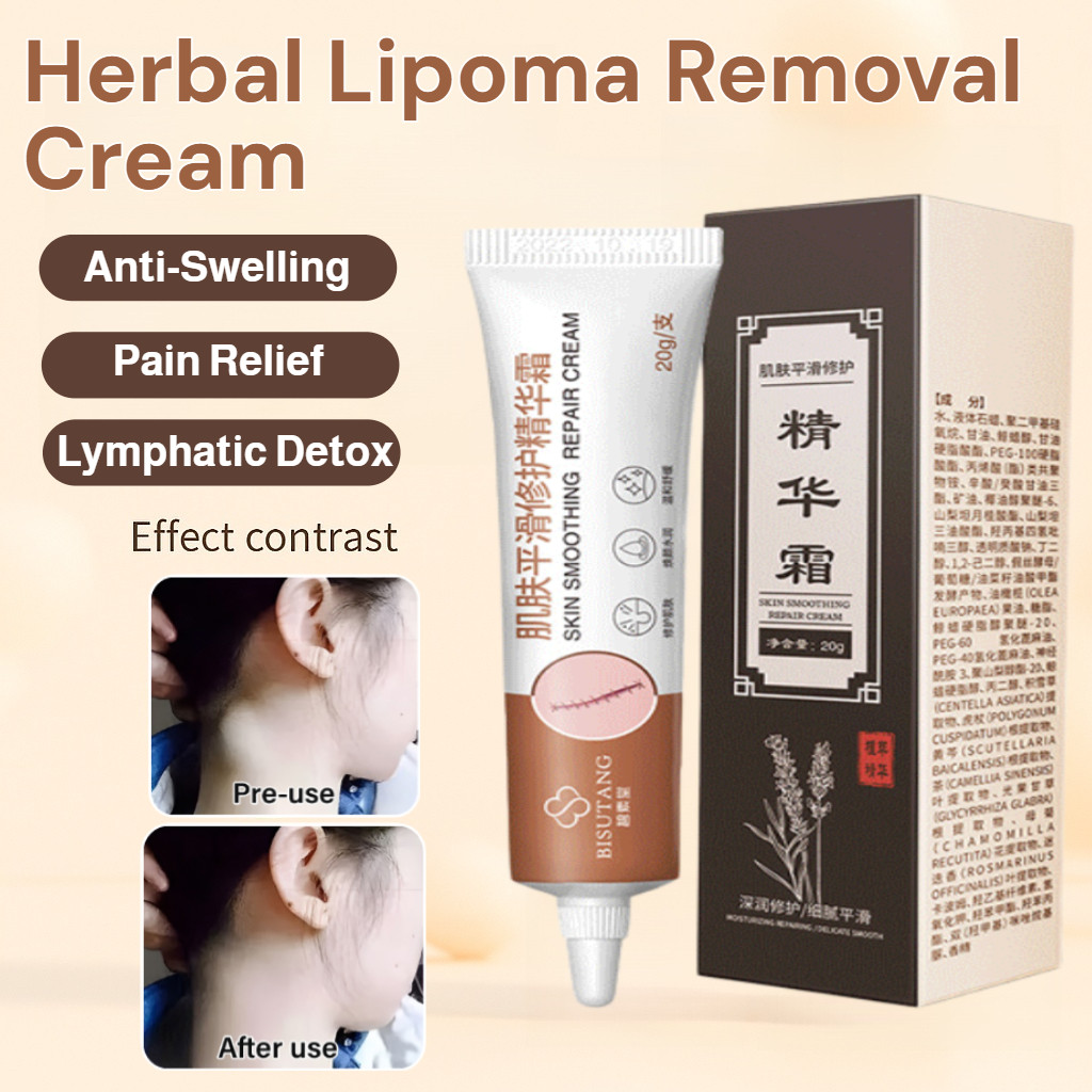 10 Day Elimination 】 Hormone free/Herbal Lipoma and Cyst Relief Cream ...