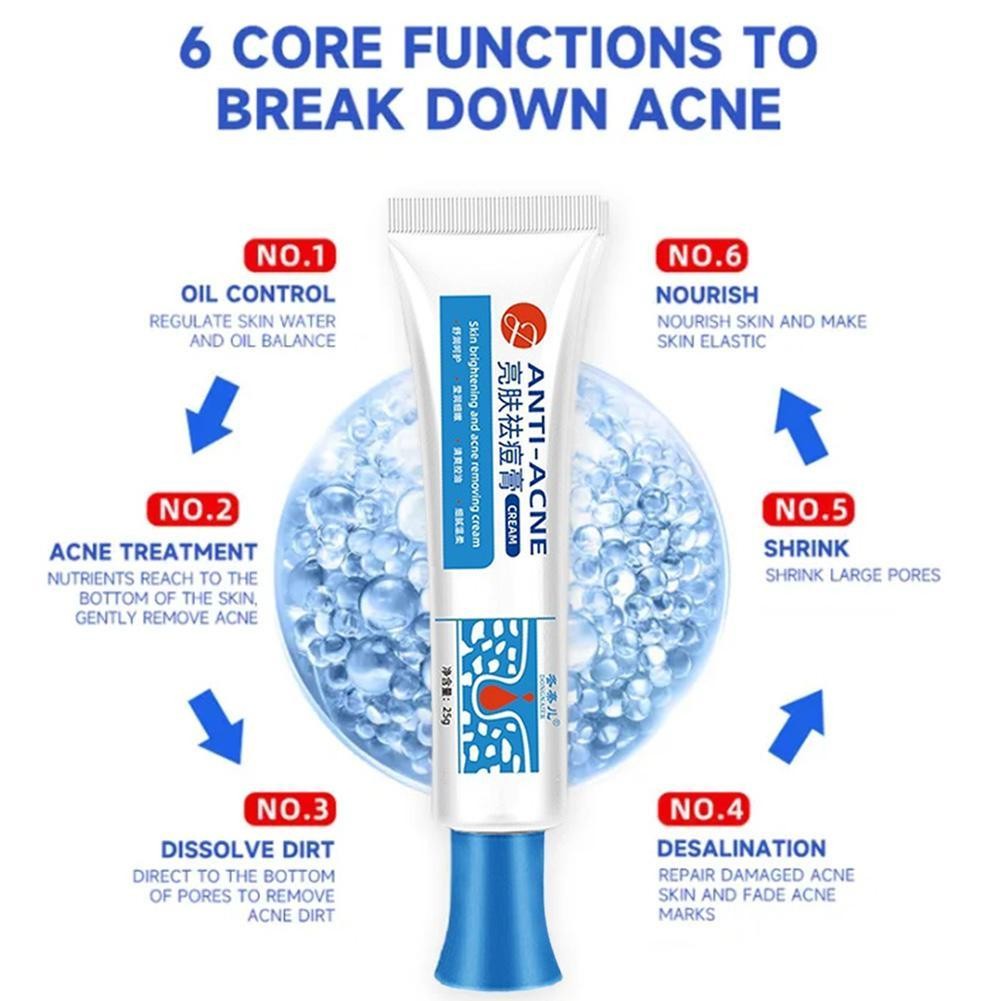 Brightening Acne Cream Facial Repair Dilute Acne Marks Skin Pimples 100 ...