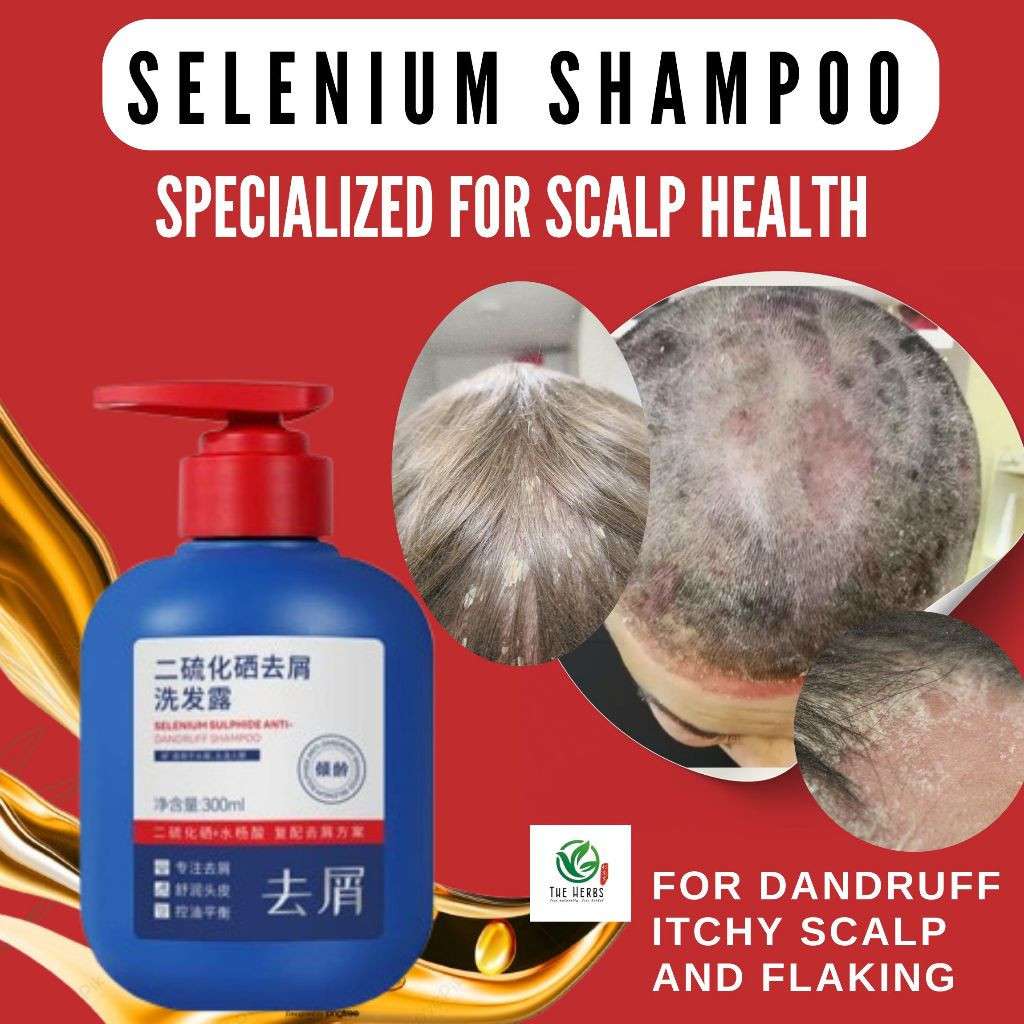 Selenium Shampoo 300ml - Formula Selenium Disulfide Khas, Merawat ...
