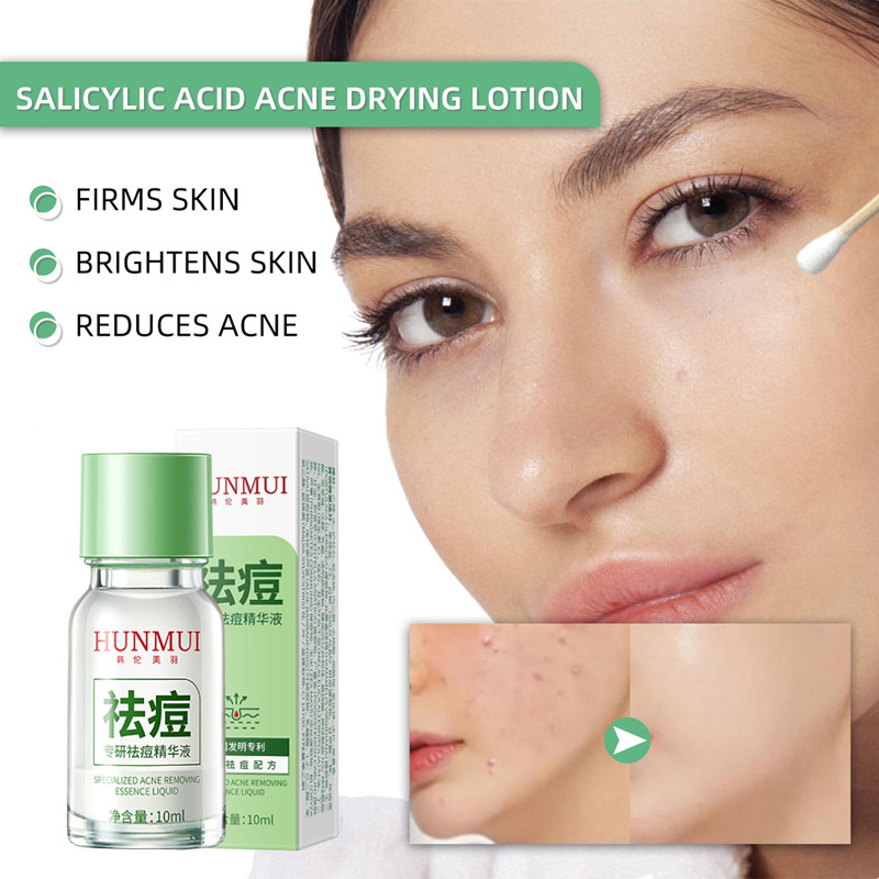 HUNMUI Colloidal Sulfur & Salicylic Acid Acne Serum Oil Control Mild ...