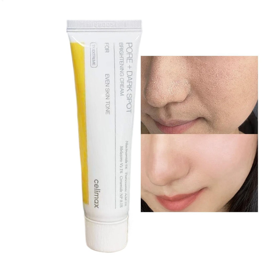 Skin Bleaching Cream 35ml Skin Lightener Moisturizing Quick Absorption ...