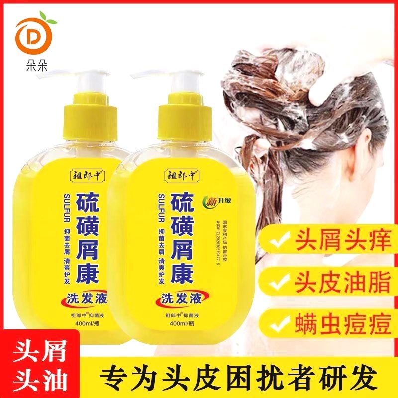 Sulfur Shampoo qu Dandruff Anti-itch qu Oil Head Lice Sulfur Upgraded ...