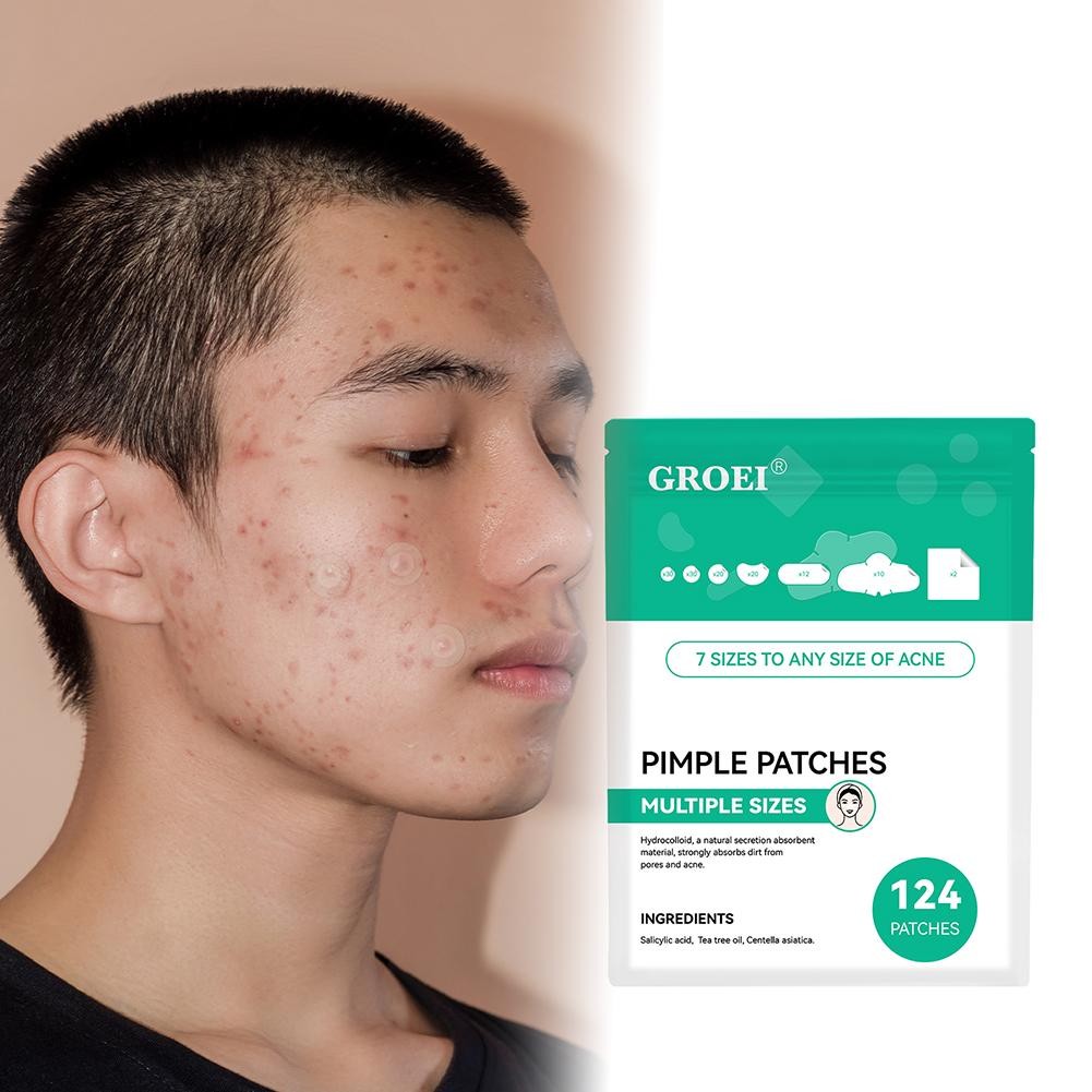Hydrocolloid Acne Patch Mild Non Pimples Irritating Patches Acne Z4k1 ...