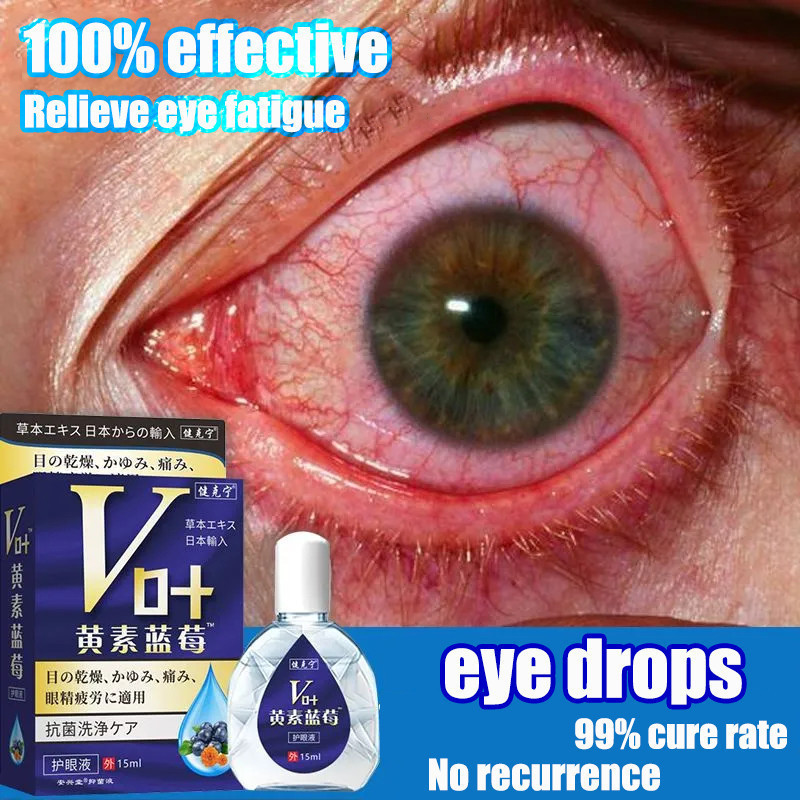 original Japanese eye drops15ML Lutein eye drop For Cataracts-Myopia ...