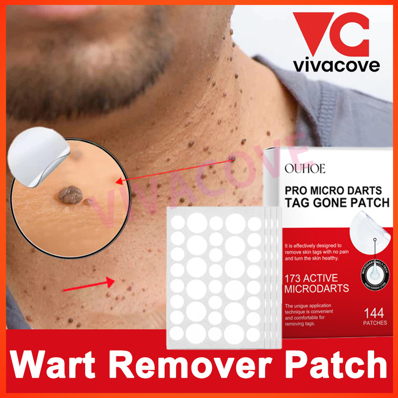 Wart Remover Patch/Wart Skin Tag Remover/Callus Corns Treatment Patch ...