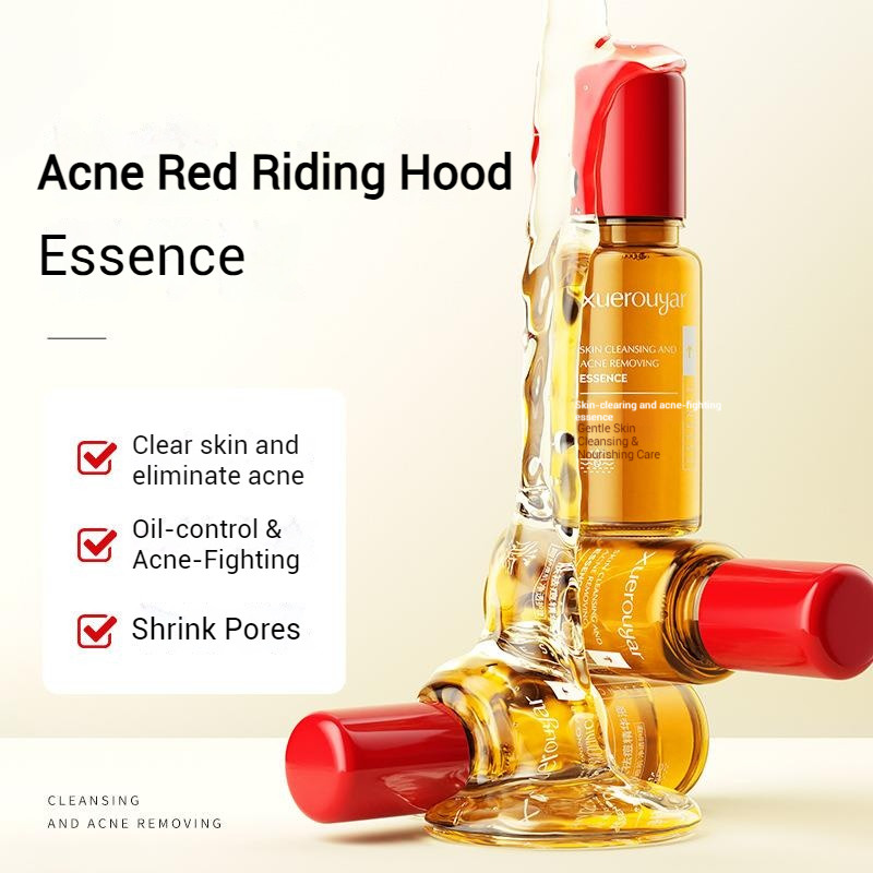 SnowyElegance "Little Red Hat" Acne Serum – Fast relief for breakouts ...