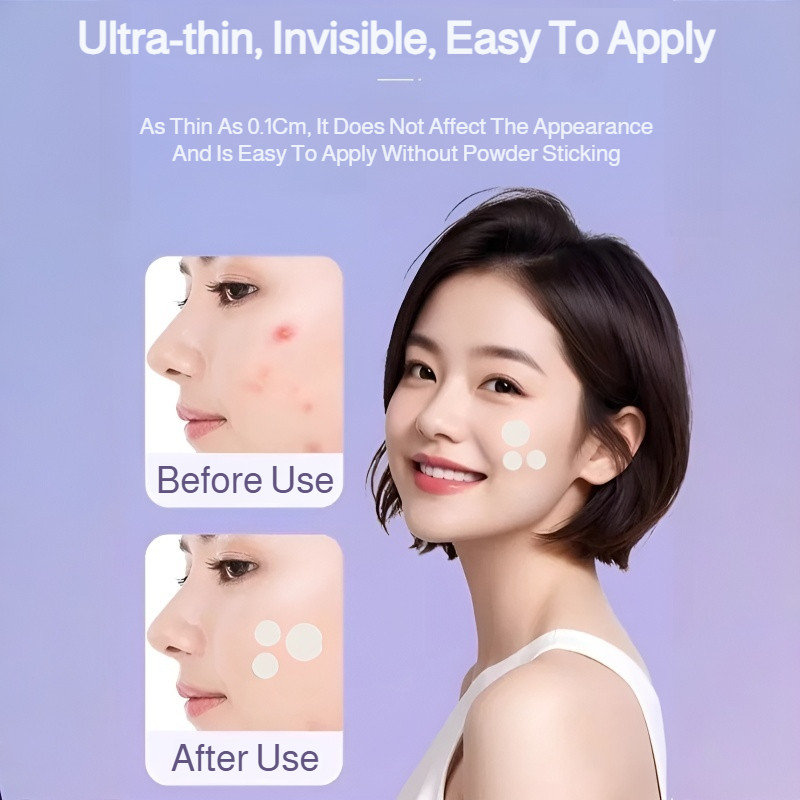 Salicylic Acid 72 Patches Particle Acne Patches Invisible Acne Scar And ...