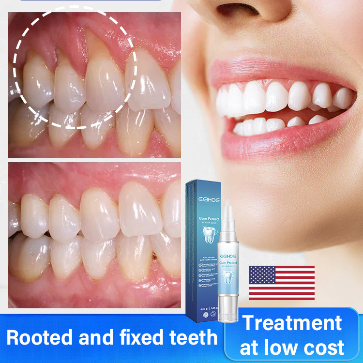 Restoration of tooth enamel Repair Gel Firmly brushed teeth Restore gum ...