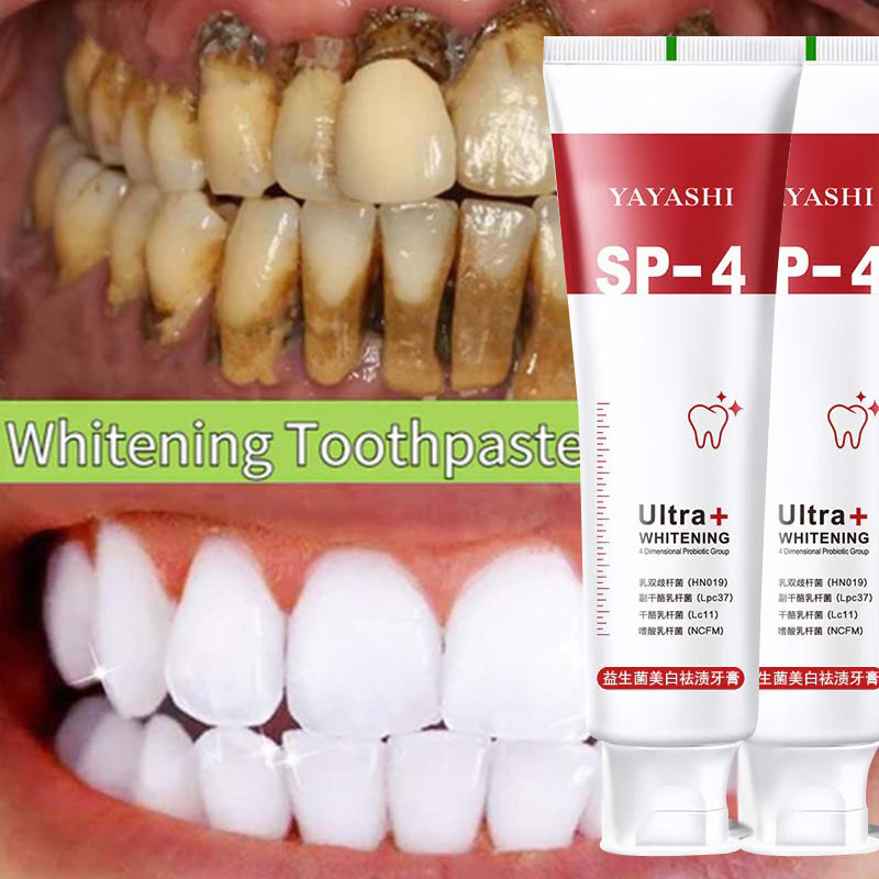 Whitening Teeth In 3 days!! Probiotic Toothpaste for Fresh Breath ...