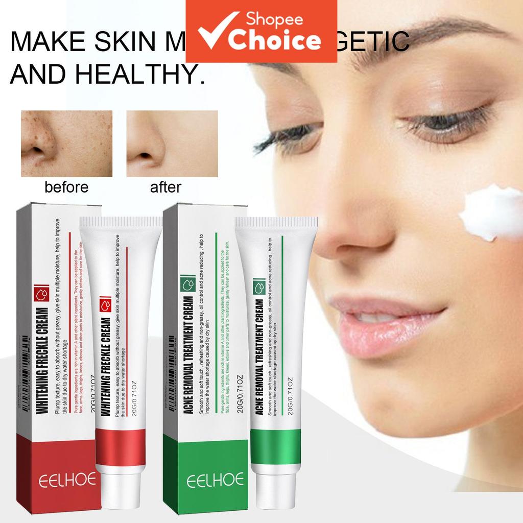 Anti-Acne Anti-Freckle Face Cream Whitening Repair Wrinkles Dark Spots ...