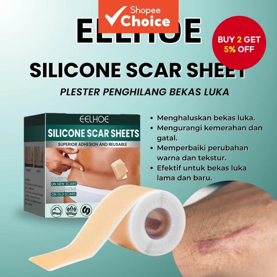 Scar Tape for Surgical Scars, Scar Away Self-Adhesive, Softens and ...