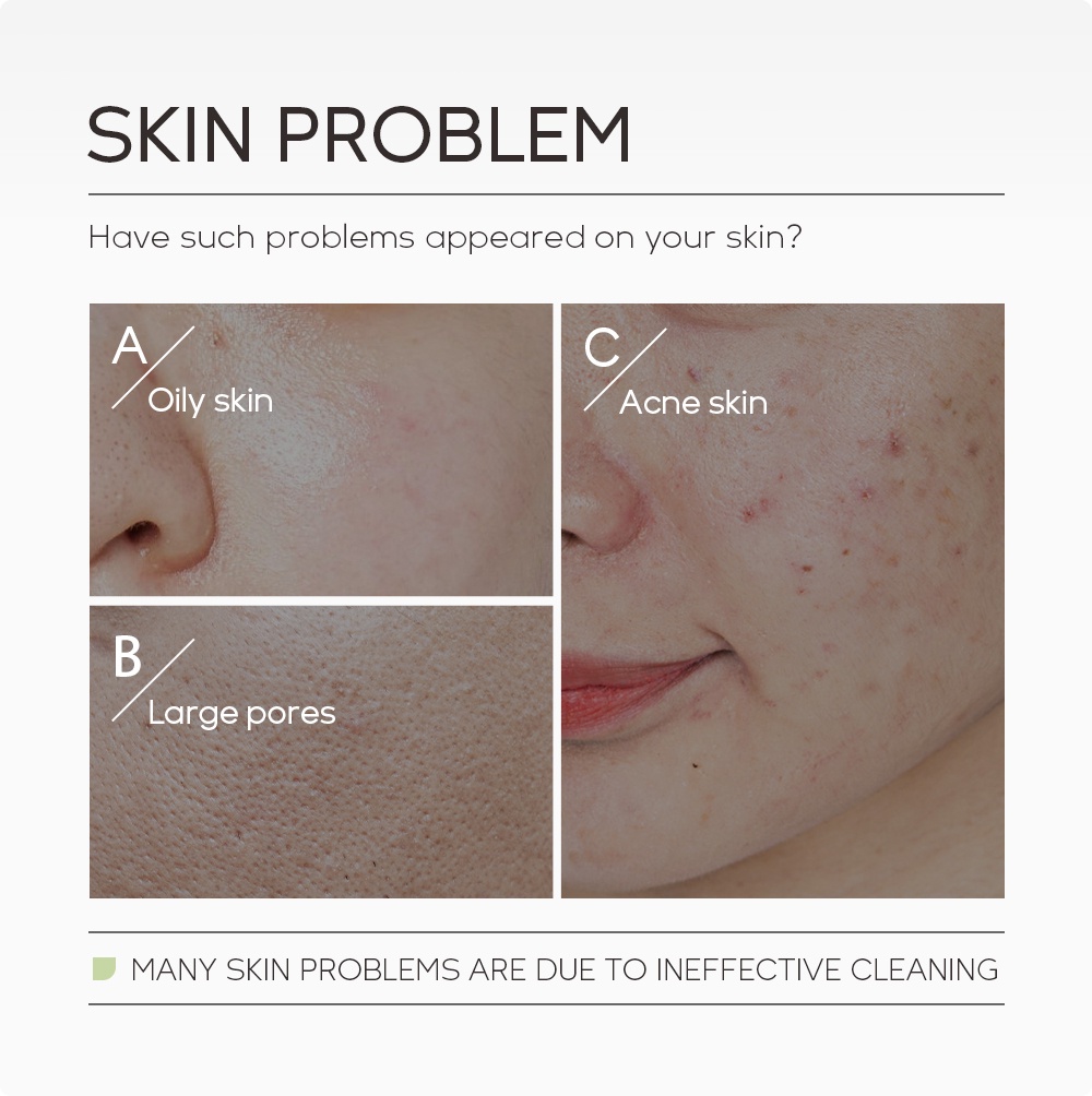 Fenyi Lab Mugwort Pore Clarifying Mask Cleansing Pores Blackhead ...