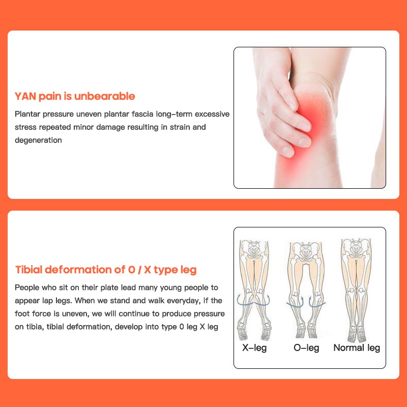 Arch Support Flatfoot Corrector Orthopedic Insole X O Leg Correction ...