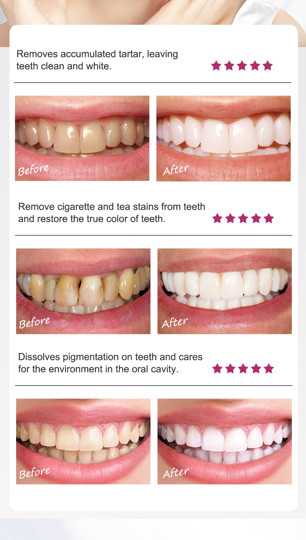 RtopR Teeth Whitening Essence Pemutih gigi Wash Yellow Teeth Remove ...