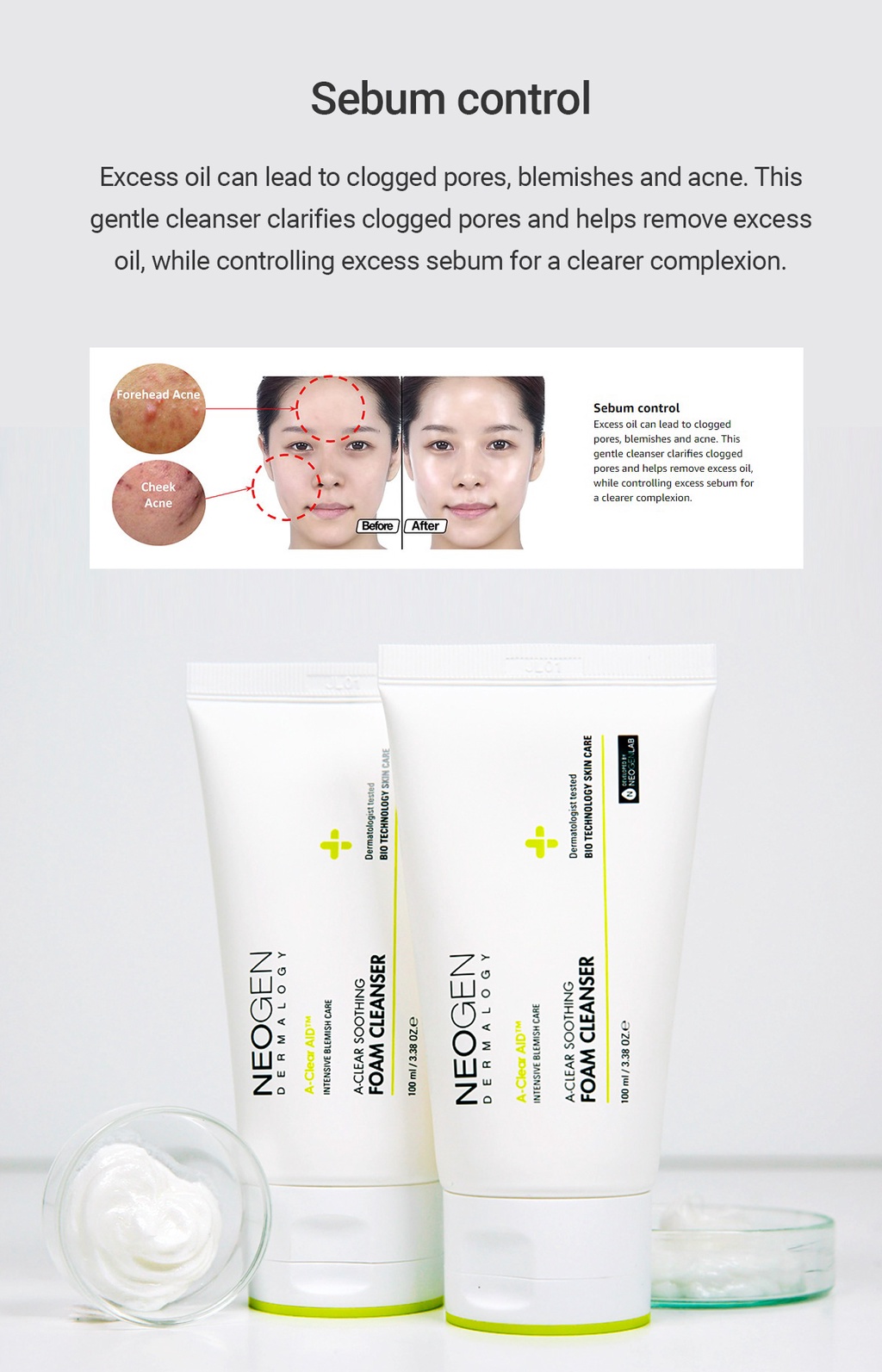 [NEOGEN DERMALOGY] A-Clear Aid Soothing Foam Cleanser (100ml) | Shopee ...