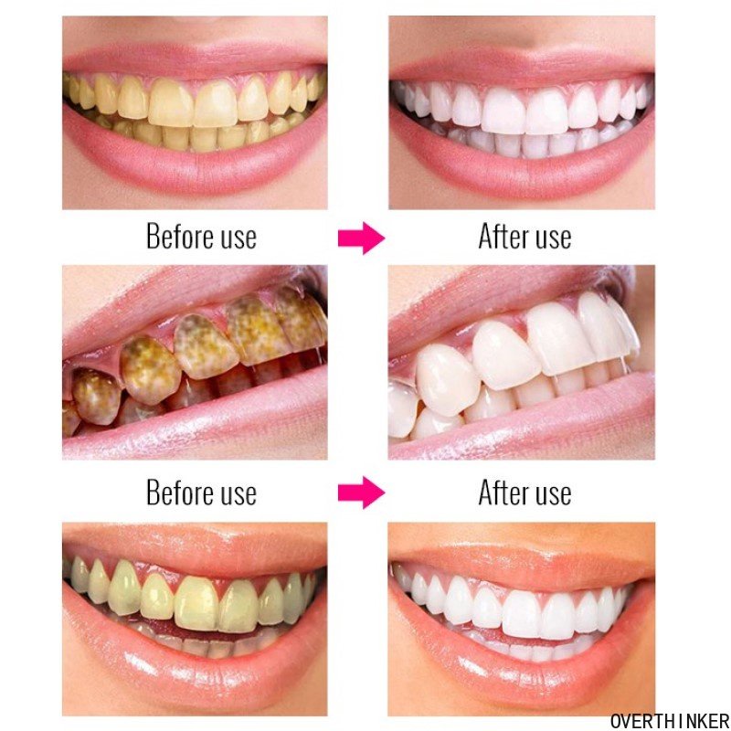Original Ubat Gigi Teeth Whitening Gigi Putih Whitening Toothpaste ...