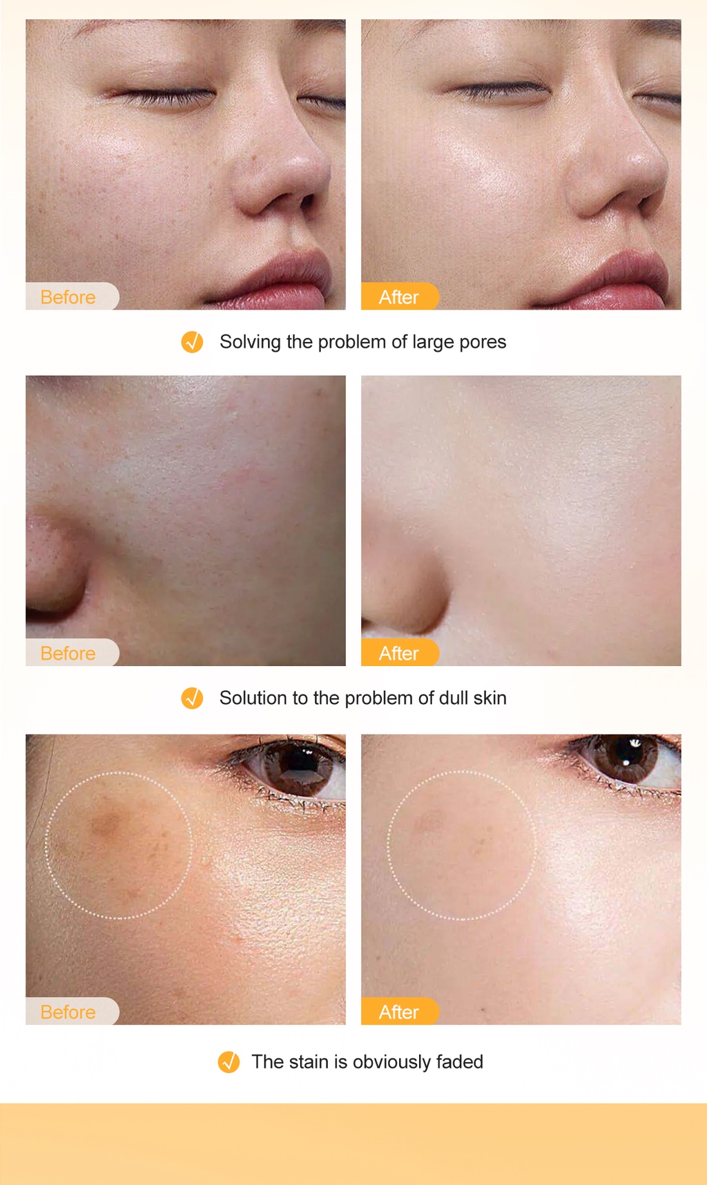 RtopR Vitamin C Whitening Moisturising Serum VC Face Essence Fade Dark ...