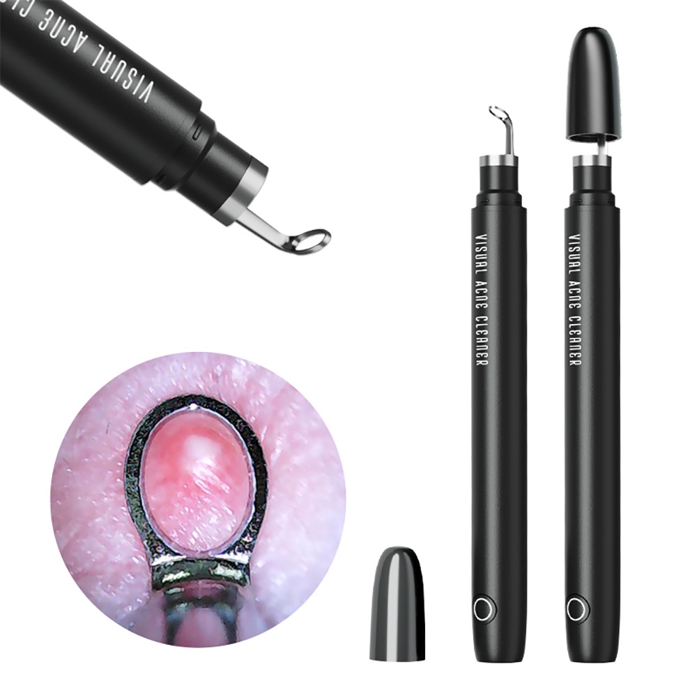 Smart Visual Blackhead Remover Acne Needle Cleansing Cosmetic Devices ...