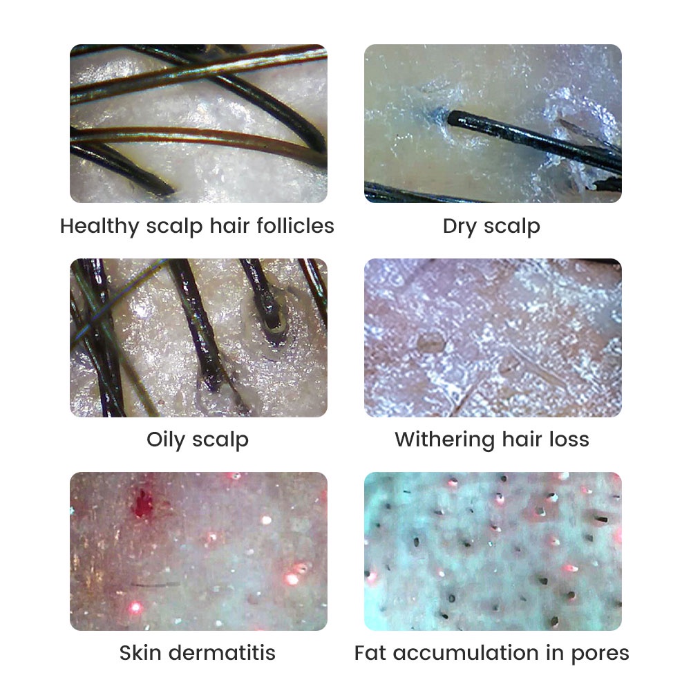 1000X Magnifier 8LED USB Digital Scalp Hair Microscope Skin Detector ...