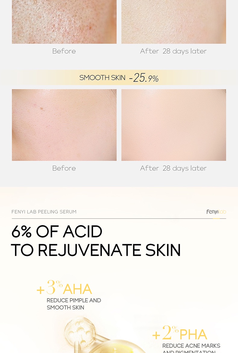 LAIKOU FENYI Lab 3% AHA Peeling Serum Niacinamide Essence Shrink Pores ...