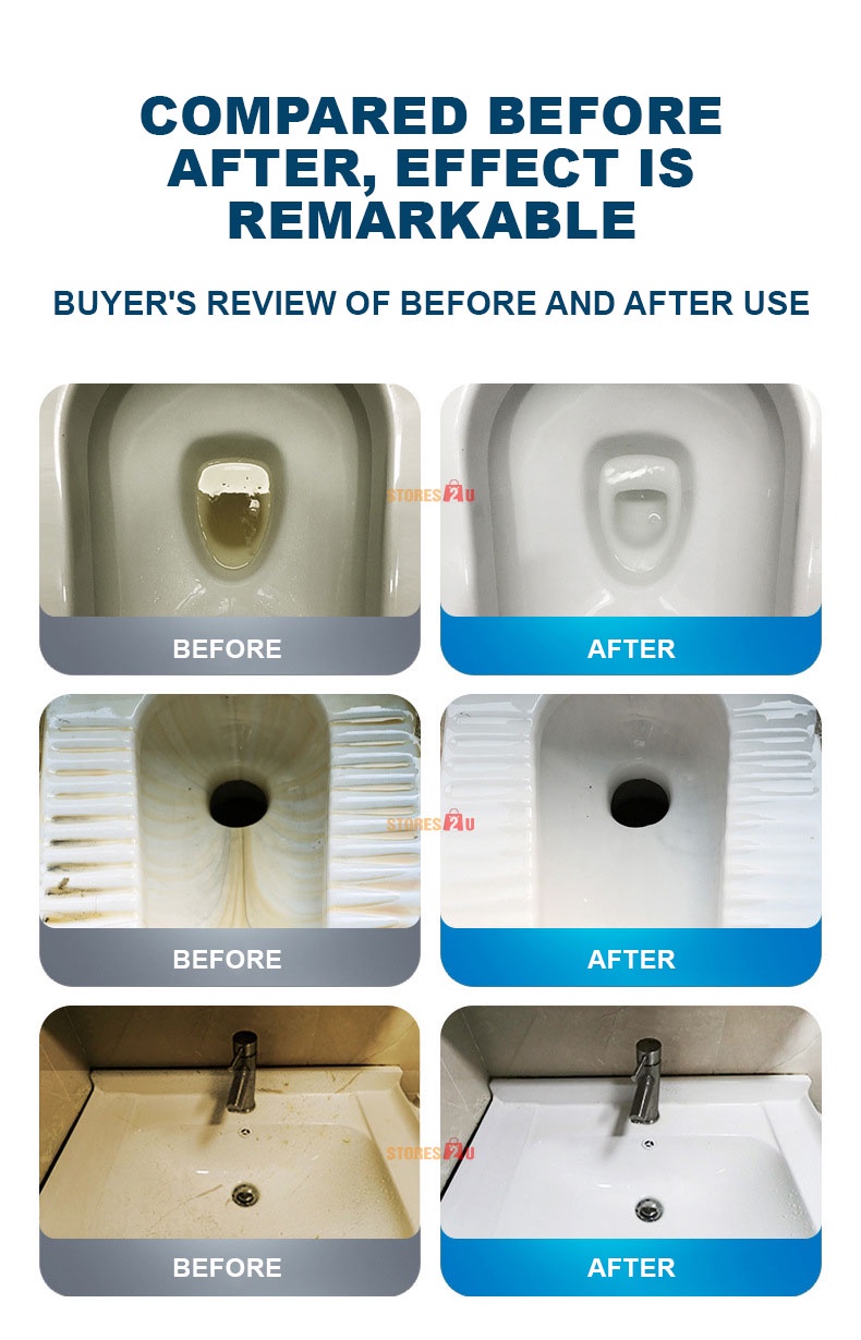 1Pack Toilet Cleaner (25g) Urine Alkali Scale Remover Decontamination ...