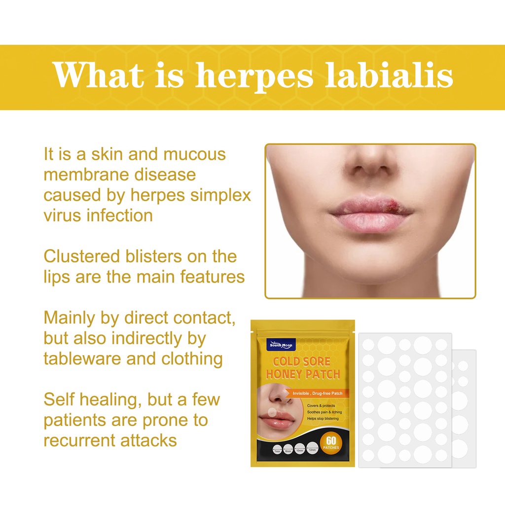 South Moon 60pcs Cold Sore Lip Patch Multifunctional Mouth Ulceration ...