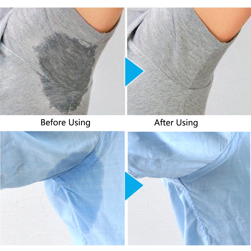 [Feature] Plantar &Underarm Sweat Patch / Men's and Women's Armpit ...
