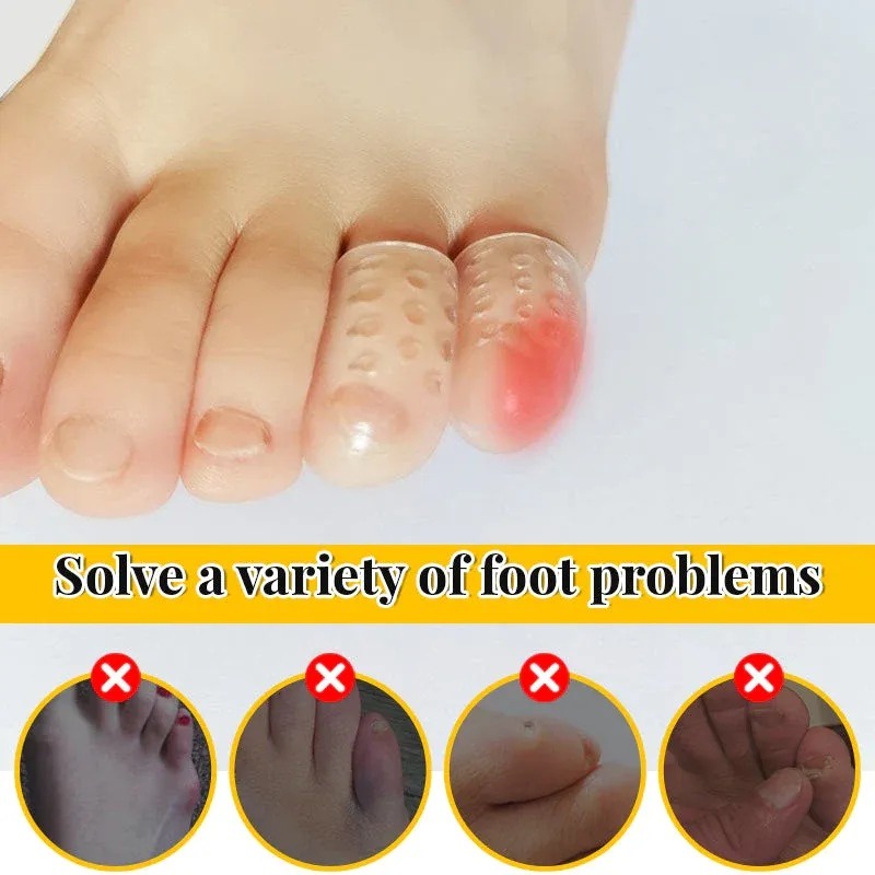 Transparent Silicone Toe Covers Breathable Anti-Friction Little Toe ...