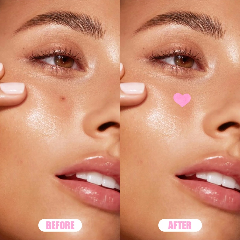 1 Pc Colorful Love Star Acne Patch Face Spot Stickers Waterproof Acne ...