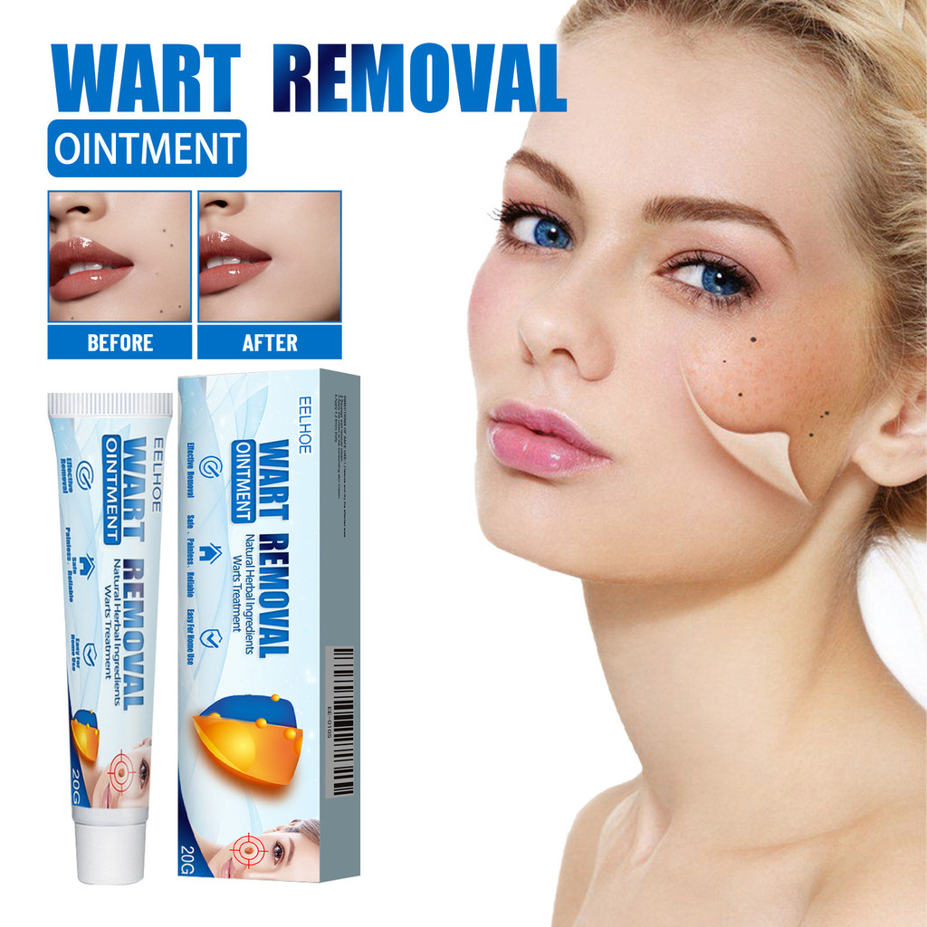Wart removal cream Original version of Clindolit Wart removal ointment ...
