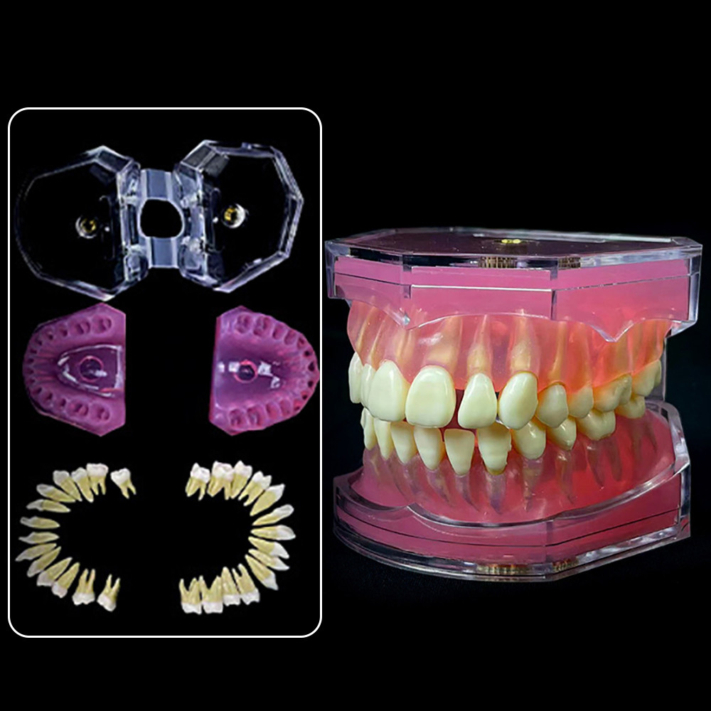 Dental Model Removable Soft Gum Tooth Model Adult Standard Dental ...