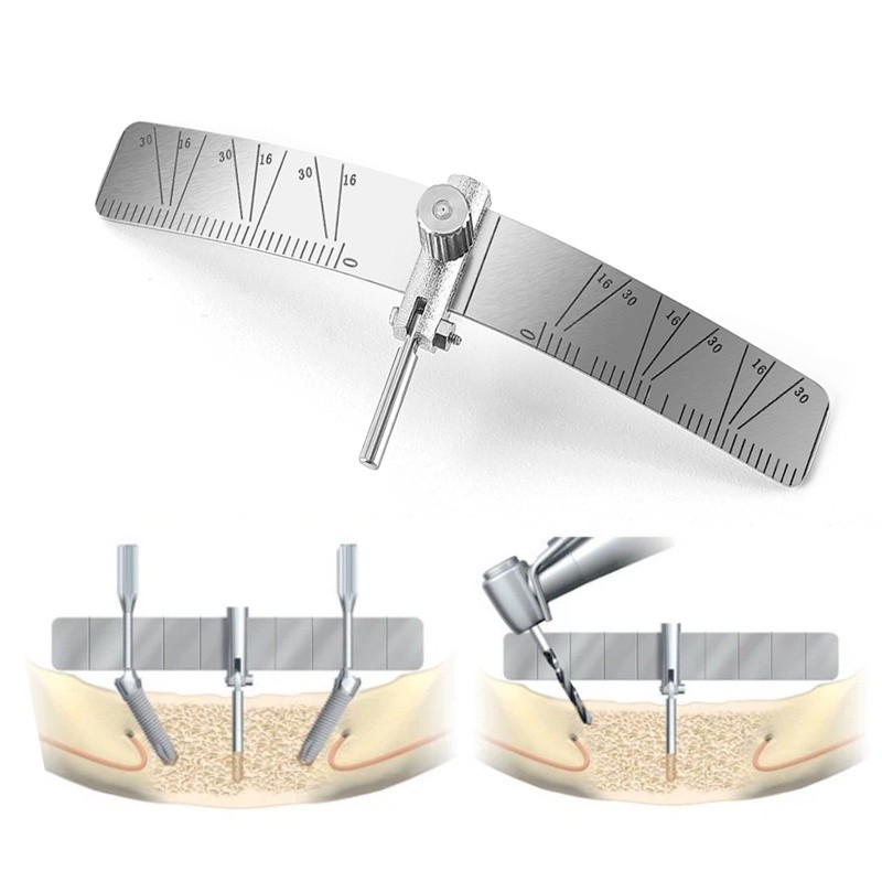Dental Implant Locating Guide Surgical Planting Positioning Locator ...