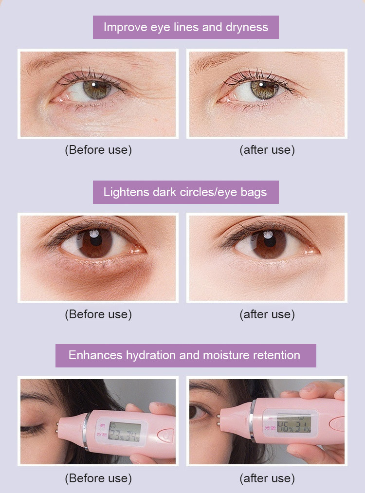 [Look Younger] Anti-Wrinkle Magic Fade Eye Fine Lines Small Purple ...