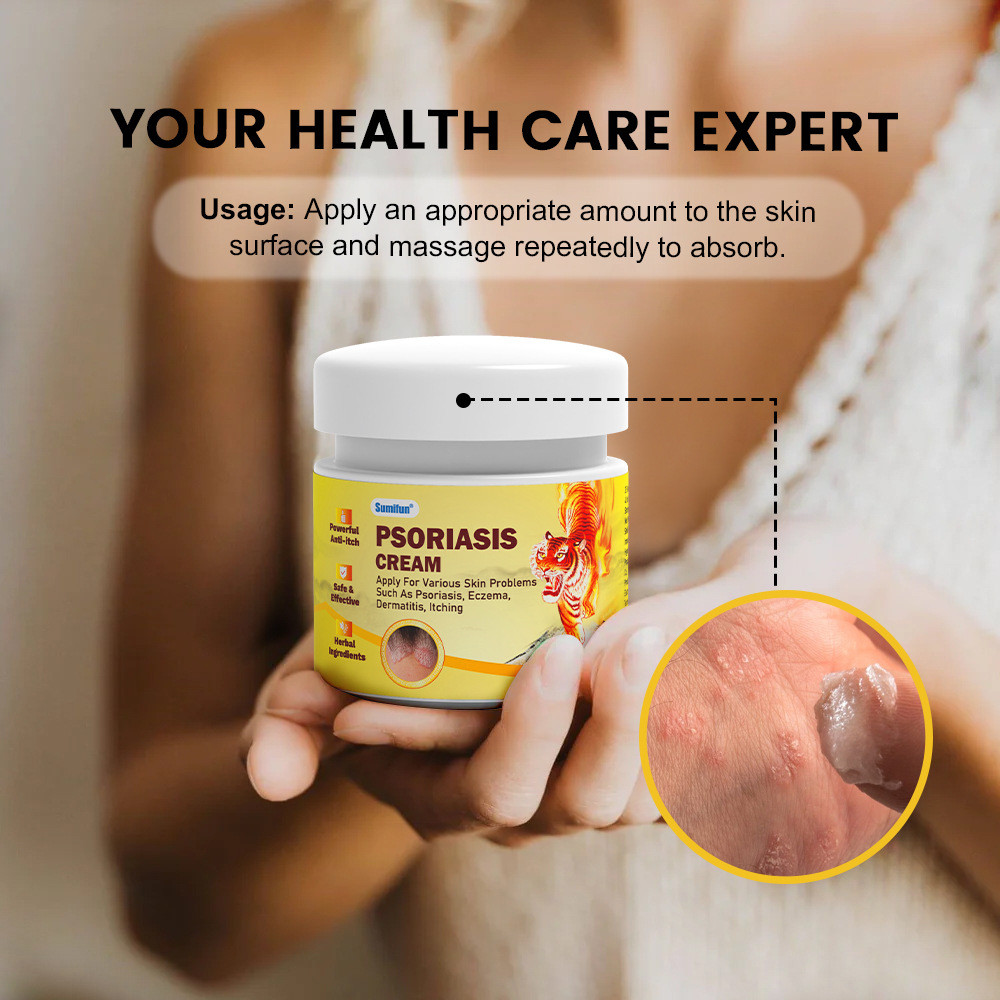 Psoriasis Cream Anti-Bacteria Anti-Itch Topical Itchy Skin Wetren ...