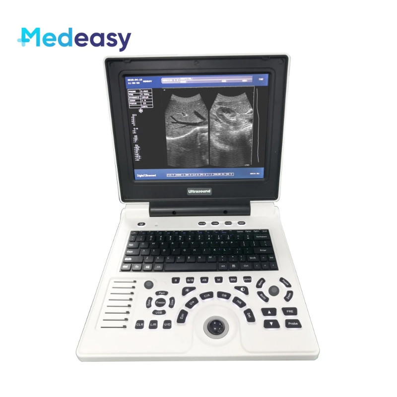 12 Inch Portable Notebook B Ultrasound Scanner Echo Machine Full ...