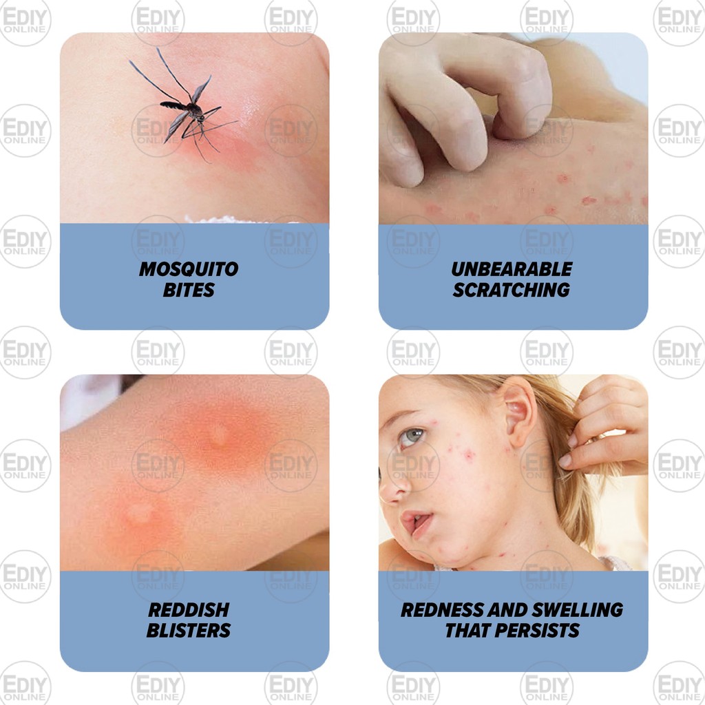 Muji-style Rechargeable Mosquito Bite Helper Anti Itch Relief Device Infrared Insect cure ...