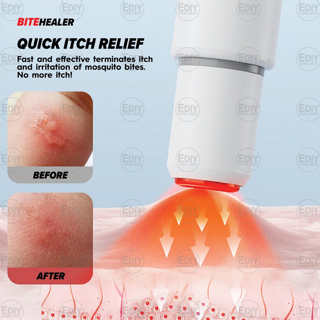 Muji-style Rechargeable Mosquito Bite Helper Anti Itch Relief Device Infrared Insect cure ...
