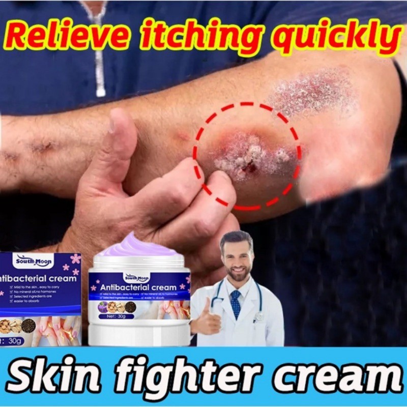 Natural Herbal Eczema Cream - Antibacterial Itch Relief for Dermatitis ...
