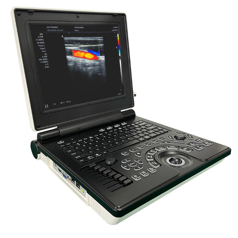 Best Price Medical Ultrasound Instruments Portable Color Ultrasound ...