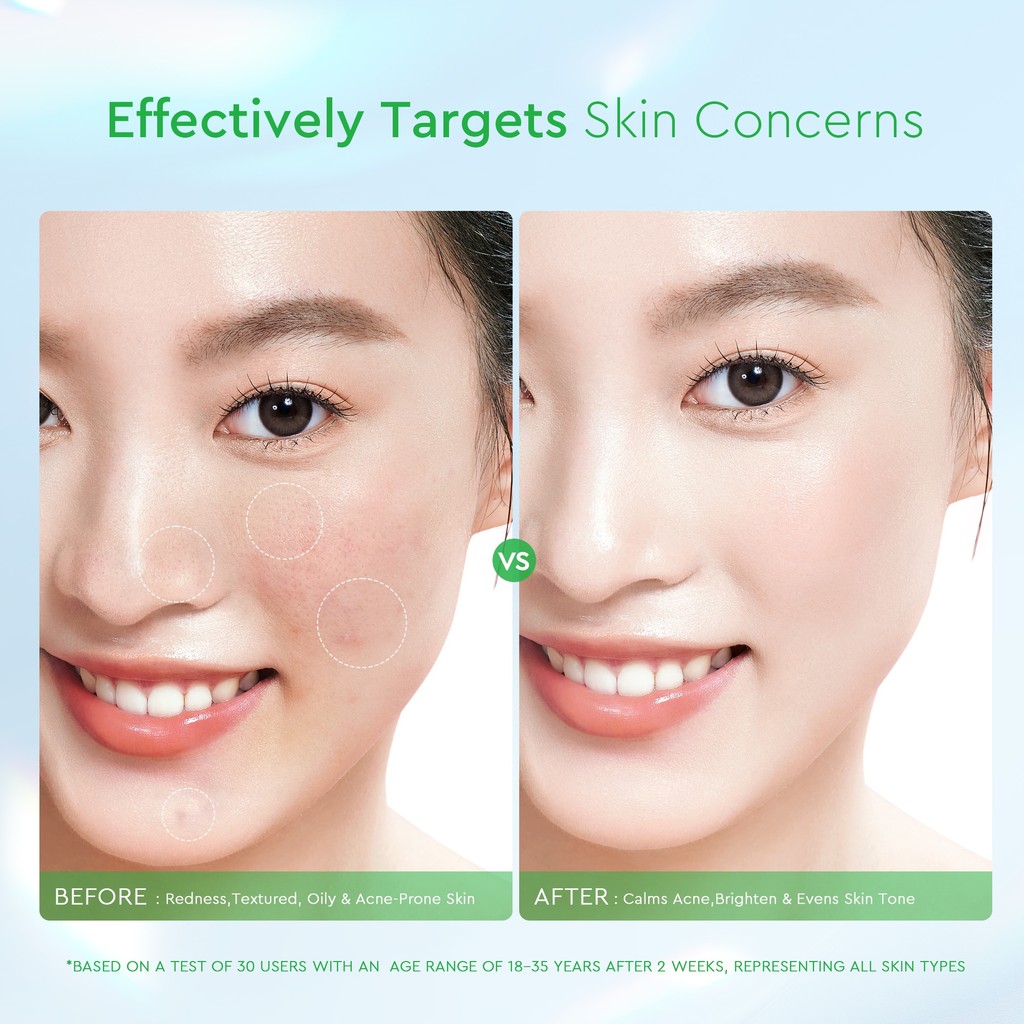 Glad2Glow Centella Salicylic Acid Exfoliating Toner Pad Clear Acne ...