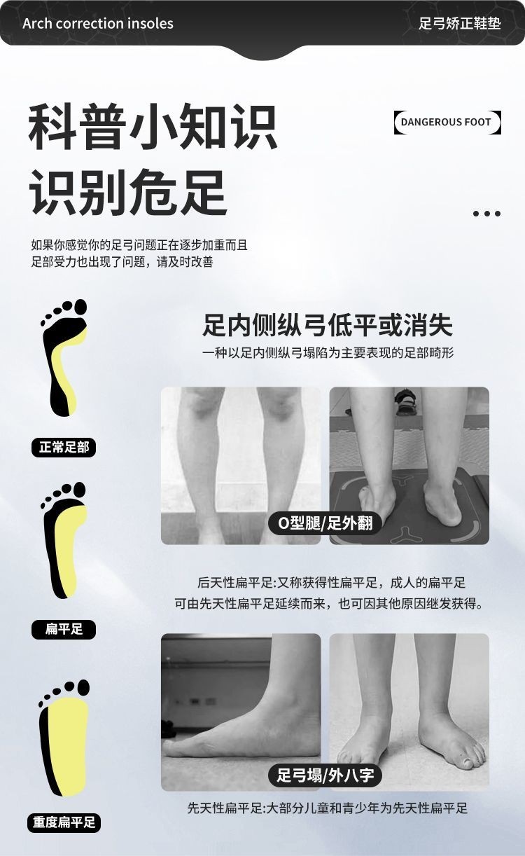 Foot Correction Insole Arch Training Device Improve xo-Shaped Leg Foot ...