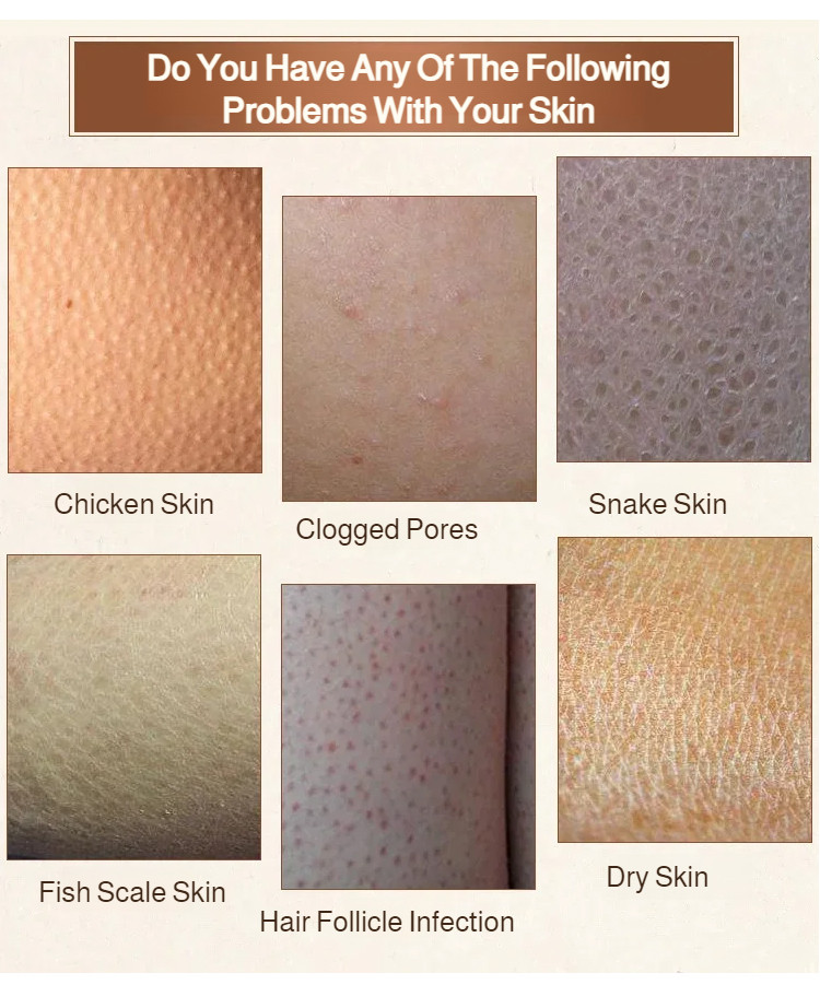 Amazing purification of hair follicles Follicle Purifying Cream ...